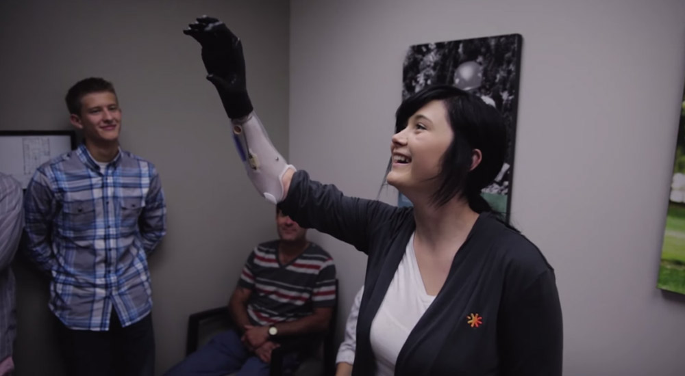 Born Without a Hand, She Dreamed of Hugging Her Father - See Her Dream ...